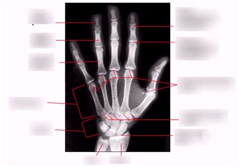 Hand Radiography Diagram Quizlet