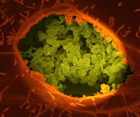 Diagnóstico microbiológico de las enfermedades infecciosas Ambar Lab