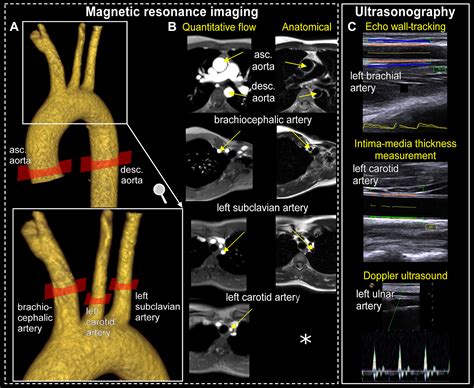 Complementing Sparse Vascular Imaging Data By Physiological Adaptation