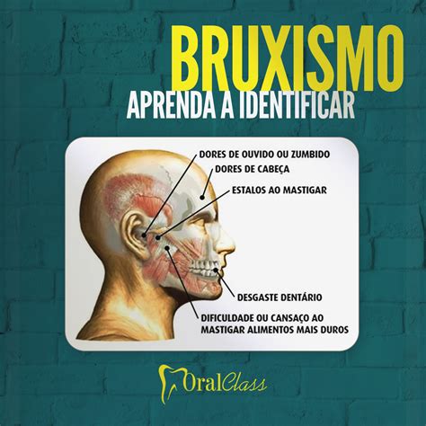 Bruxismo Aprenda A Identificar Oral Class