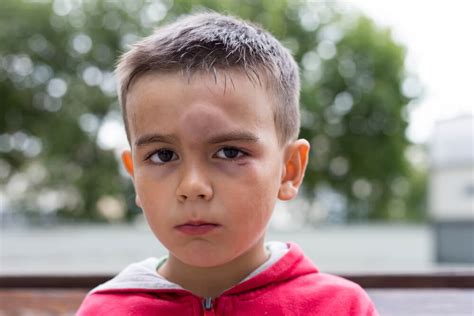 Golpes en la cabeza en niños todo lo que necesitas saber