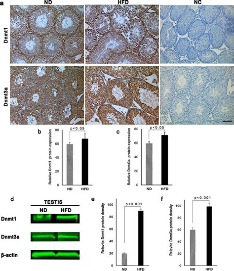 Effect Of HFD On Dnmt1 And Dnmt3a Expression In Mouse Testis