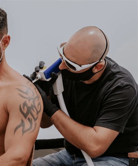 Eliminaci N De Tatuajes Con Laser Es Inkbro
