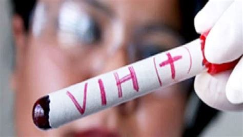 Se Cumplen A Os Del Descubrimiento Del Virus Del Sida