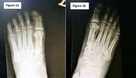 Case Report Series British Journal Of Medical Practitioners