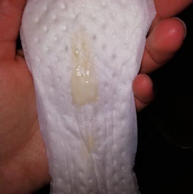 Ayuda Semanas Y Flujo Parecido Tap N Mucoso Babycenter