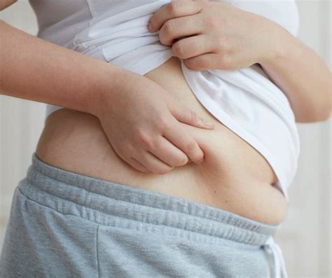 Obezite Cerrahisi Nedir Kimler Tüp Mide Ameliyatı Olabilir