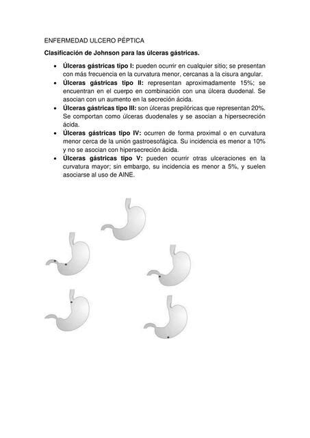 Tratamiento de la enfermedad ulcero péptica Alejandro 86 uDocz