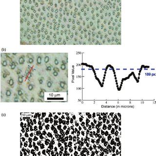 PDF Peritubular Dentin A Highly Mineralized Non Collagenous