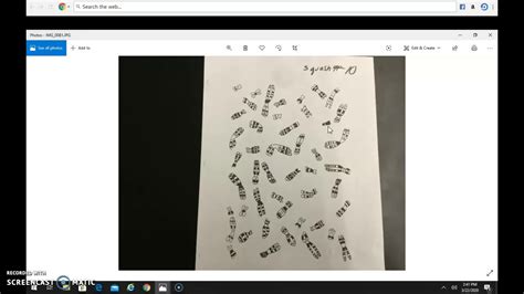 Karyotype Lab Bio Youtube