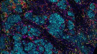 a guide to spatial transcriptomics