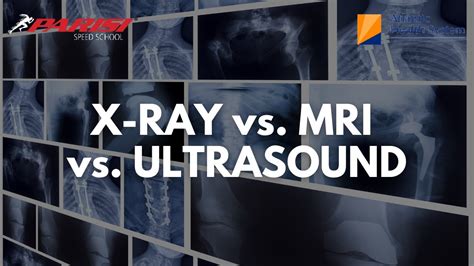 Understanding The Difference Xray MRI Ultrasound Dr Neil Pravin