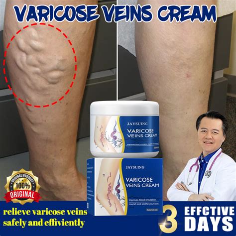 100 Effective JAYSUING Varicose Veins Remover Effective Angiitis