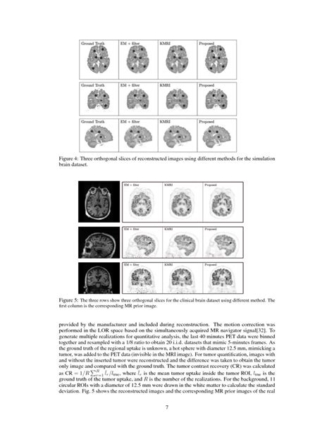 learning personalized representation for inverse problems in medical imaging using deep neural
