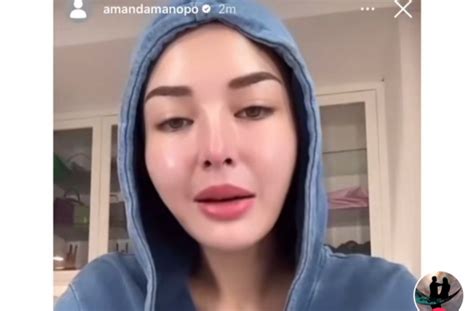 Alami Perubahan Drastis Hasil Diduga Oplas Wajah Amanda Manopo Bikin