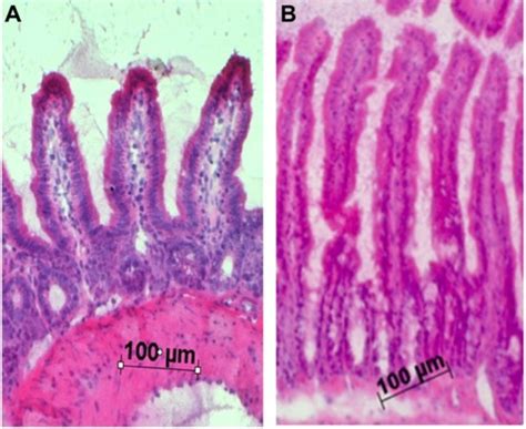 Full Article Decreased Basal Chloride Secretion And Altered Cystic