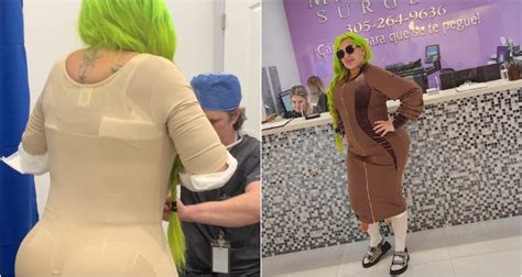 La Diosa muestra como quedó tras la cirugía estética VIDEO