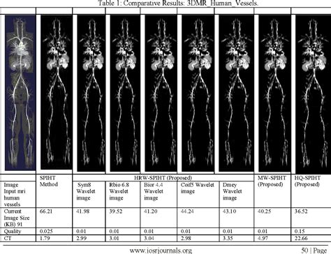 table 1 from improving quality of medical image reconstruction using wavelet based modified