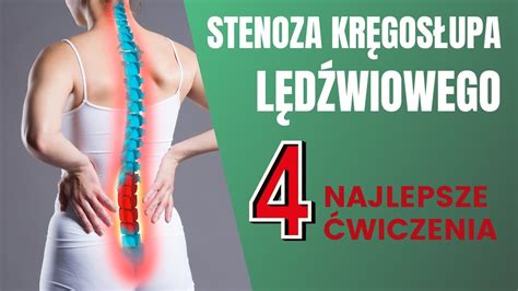 Stenoza kręgosłupa 4 najlepsze ćwiczenia likwidujące ból YouTube