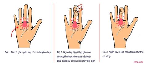 Chia sẻ với hơn 72 về hình ngón tay mới nhất coedo vn