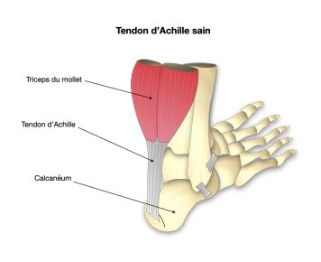 Tendinite Du Tendon D Achille Dr Bovier Lapierre
