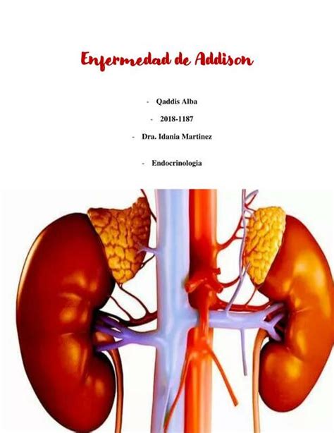 Enfermedad De Addison Alba UDocz