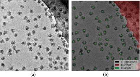 urdnet a cryo em particle automatic picking method