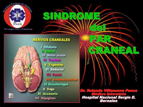 Síndrome del Par Craneal Ahmed Casana uDocz
