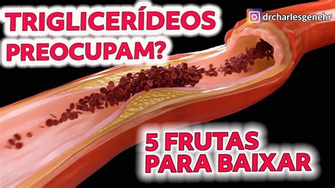 Melhores Frutas Para Baixar Os Triglicer Deos Altos Dr Charles