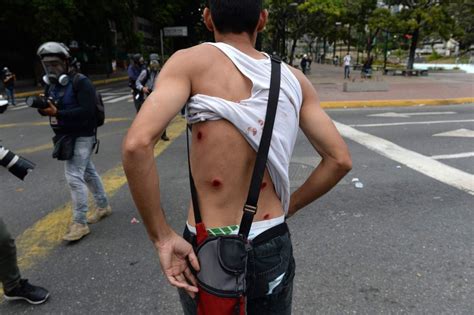 Fotos Enfrentamientos Entre Manifestantes Y Fuerzas De Seguridad En