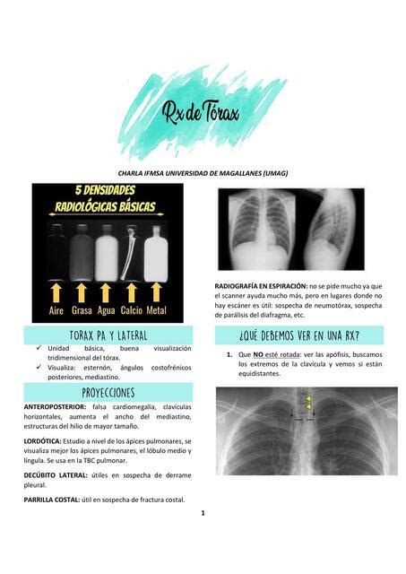 Rx de Tórax Ari Valenzuela uDocz