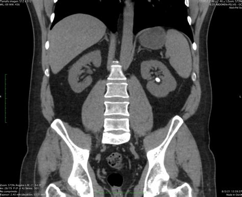 Corte Axial Coronal E Sagital Tomografia BRAINCP