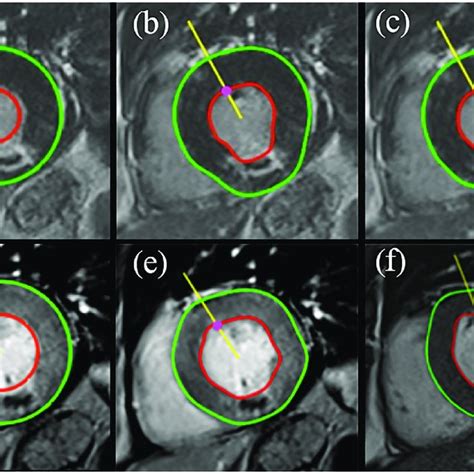 Performance Of BEAS Segmentation On Images With Different Contrast