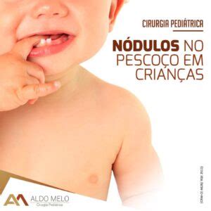 NÓDULOS CERVICAIS EM CRIANÇAS Dr Aldo Melo Cirurgia Pediátrica