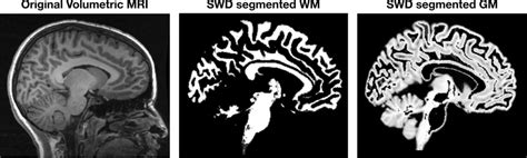 automated human brain tissue segmentation using the spherical wave download scientific diagram
