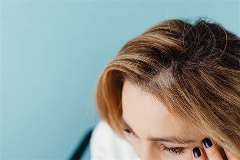 Abaissement De La Racine Des Cheveux Un Guide Sur La Chirurgie De