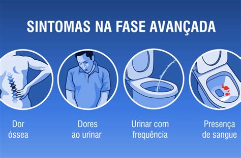 Día Nacional de la Lucha contra el Cáncer de Próstata 29 de noviembre