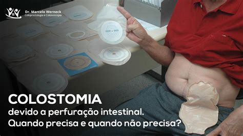 Saiba Mais Sobre Perfura O Intestinal E A Necessidade De Colostomia