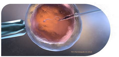 Insemina O Artificial Veja Quando Ela Pode Ser Indicada Elo