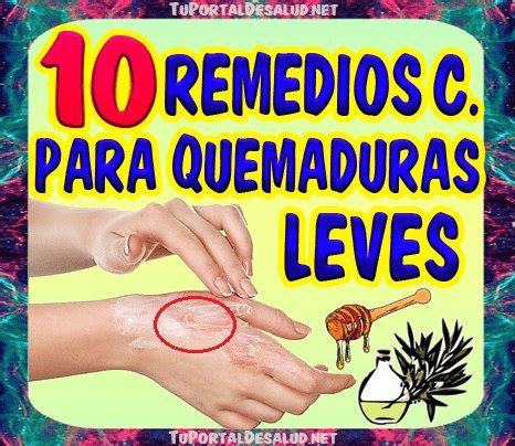 10 Remedios Caseros Para Quemaduras Leves Tu Portal De Salud
