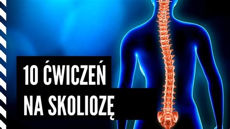 10 Ćwiczeń na skoliozę przykłady rodzaje YouTube