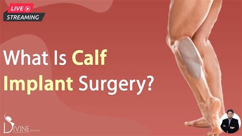 What Is Calf Implant Surgery Youtube