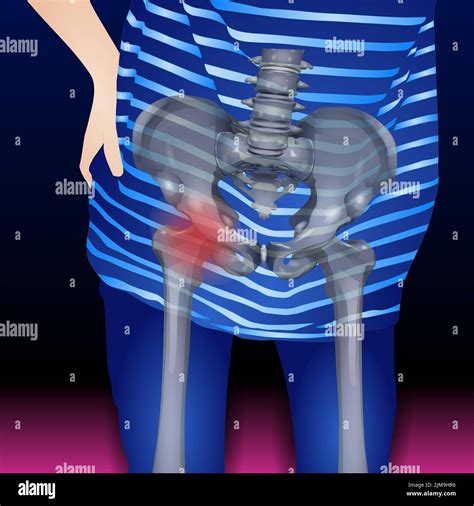 Il sistema urinario umano è costituito da reni pelvi renale uretere