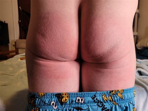 Azote El Trasero Desnudo Chicas Desnudas