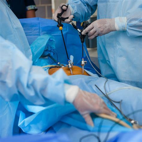 Minimally Invasive Endoscopic Surgery HK Surgeon