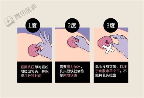 乳晕长小疙瘩正常吗？乳头这5种变化，真的不用担心澎湃号·湃客澎湃新闻 The Paper