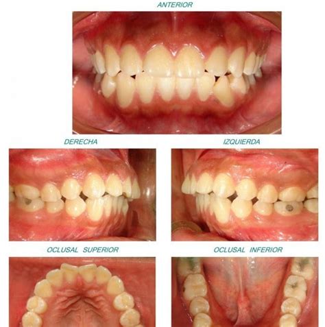 FOTOGRAFIAS INTRAORALES MEDICAL DENTIX S A C