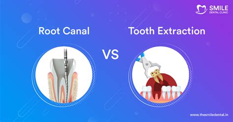 Root Canal Vs Tooth Extraction Making The Best Choice For Your Teeth