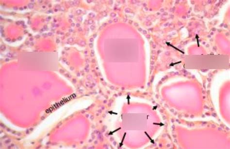 Thyroid Follicle Diagram Quizlet