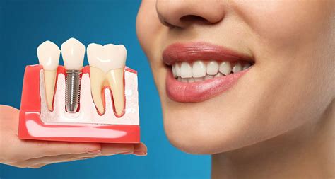 Advantages And Disadvantages Of Dental Implant Dentevim Dental Clinic